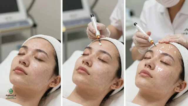 How Much Does a Face Lift Cost? Book Consultation Now